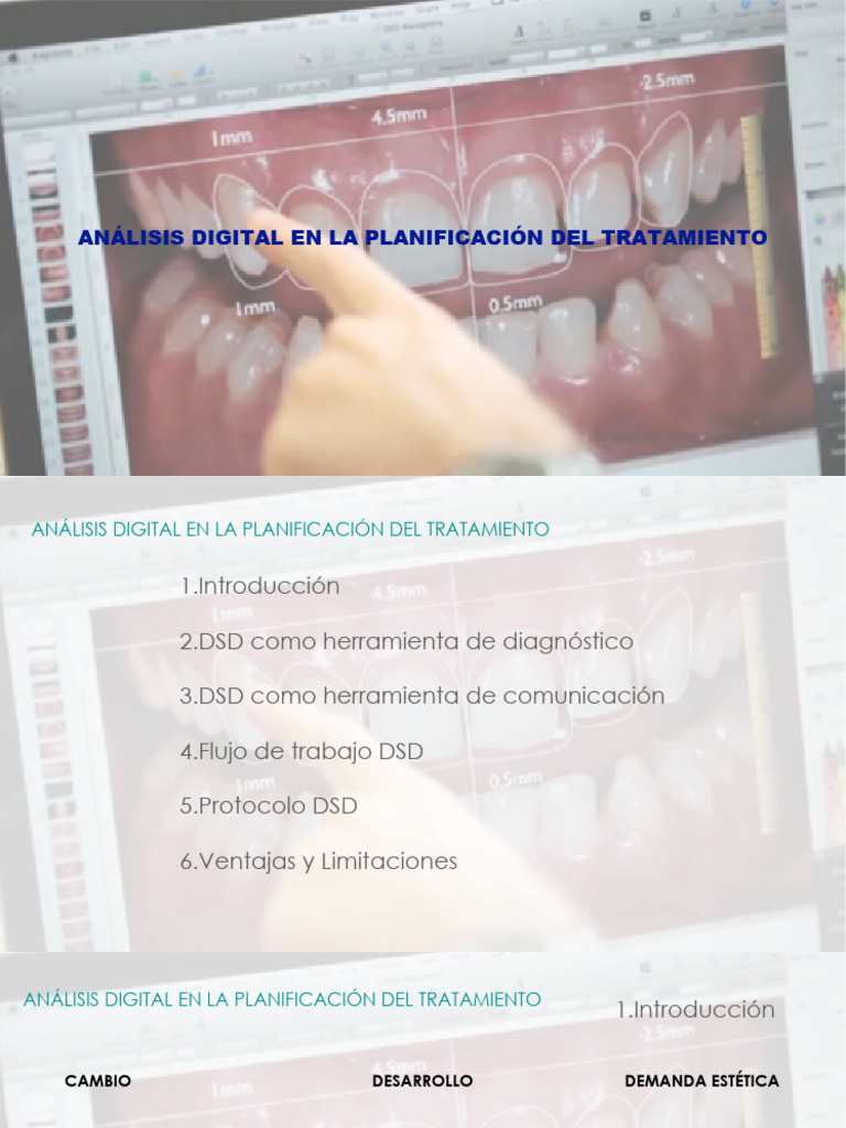 T 31. - . - Análisis Digital DSD | PDF | Ortodoncia | Especialidades Medicas