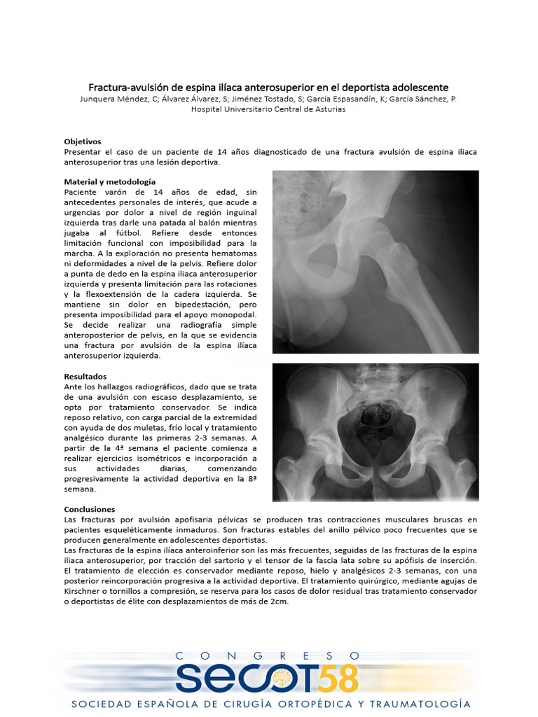 8726 | PDF | Pelvis | Sistema musculoesquelético