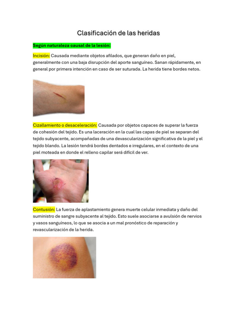 Clasificación Legal de Las Heridas | PDF | Herida | Piel