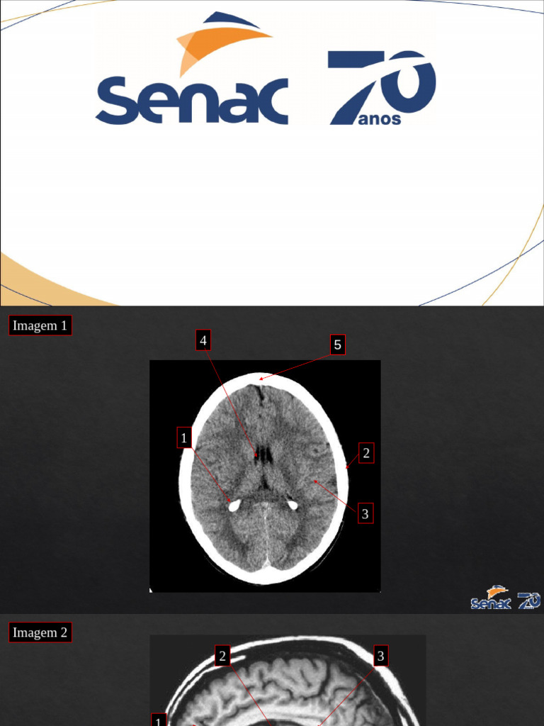 Atividade EAD 01 | PDF