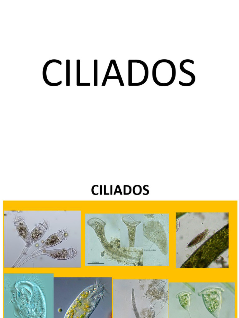 Odontostomatida: Ciliados y Clasificación | PDF