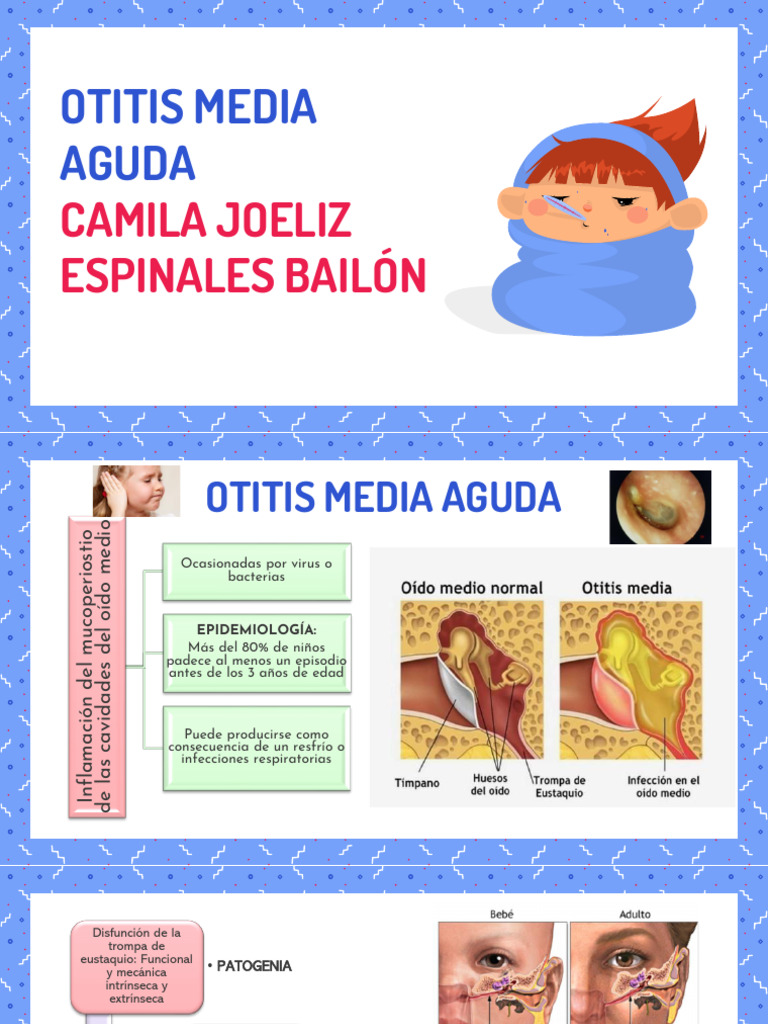 Otitis Media Aguda | PDF