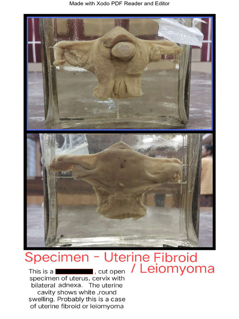 Pathology Specimens Combined | PDF