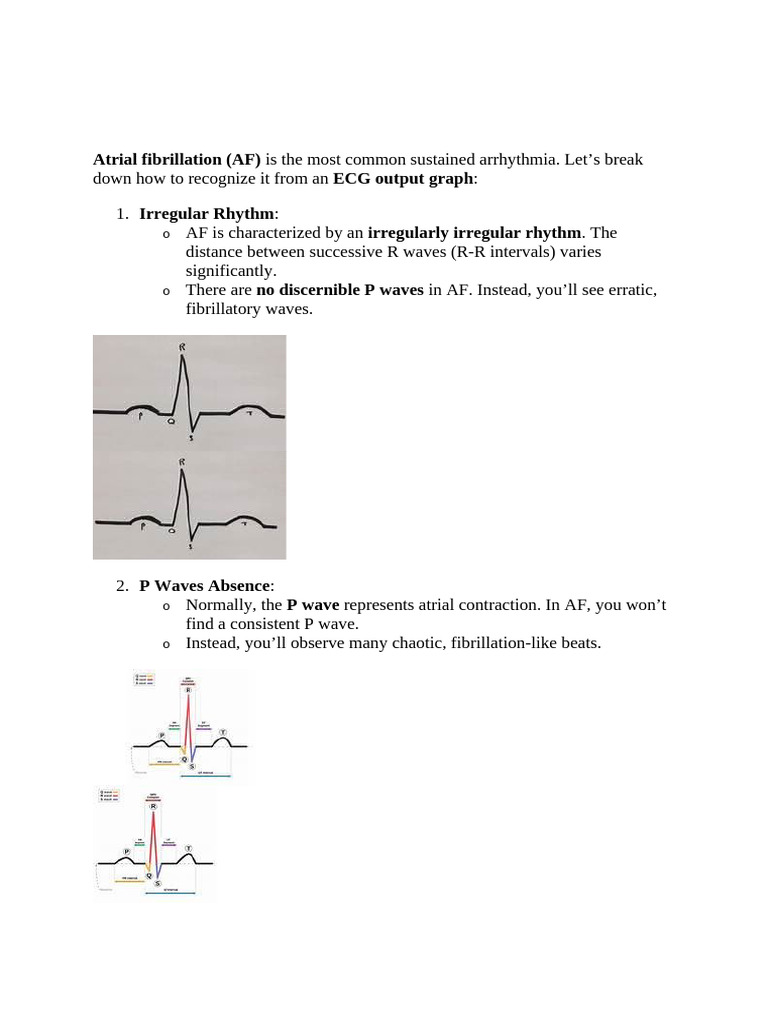 Indication and Prevention of Atrial Fibrillation | PDF | Heart Rate ...