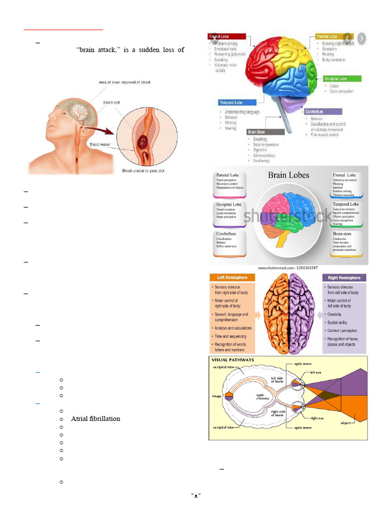 Understanding Cerebrovascular Accidents | PDF | Stroke | Ischemia