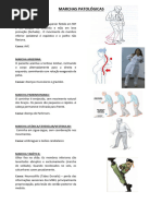 Tipos de Marchas Patológicas na Fisioterapia | PDF | Fisioterapia ...