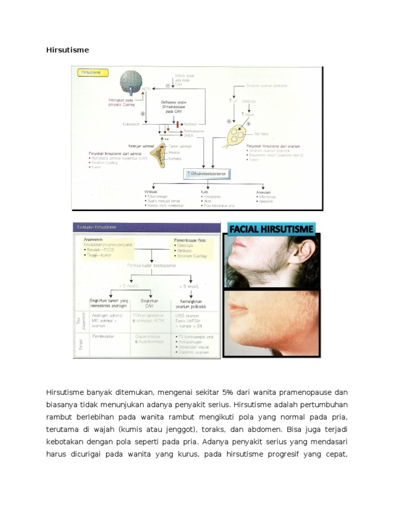 Hirsutisme | PDF