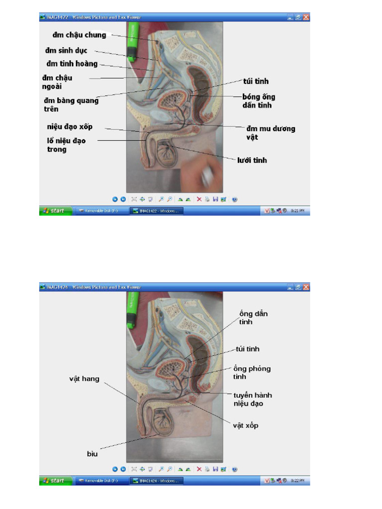 M14 Hình THGP | PDF