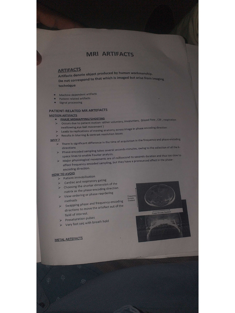 Mri Artifacts | PDF
