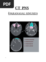 MRI Protocol for Paranasal Sinuses | PDF | Anatomy | Human Anatomy