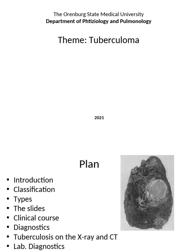 Tuberculoma Tb | PDF | Tuberculosis | Lung