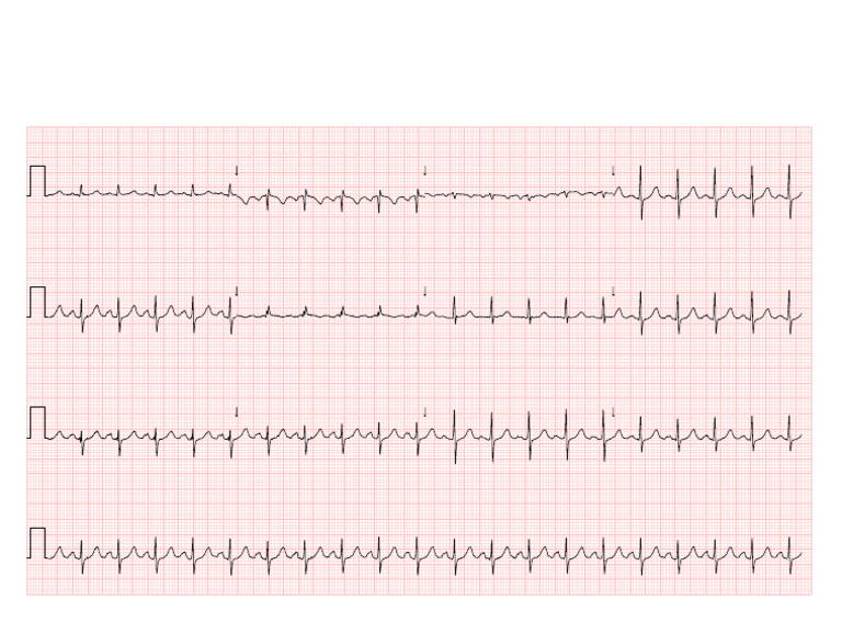 R ECG 0 Silva Emma 20250119114004 20250119110325 | PDF