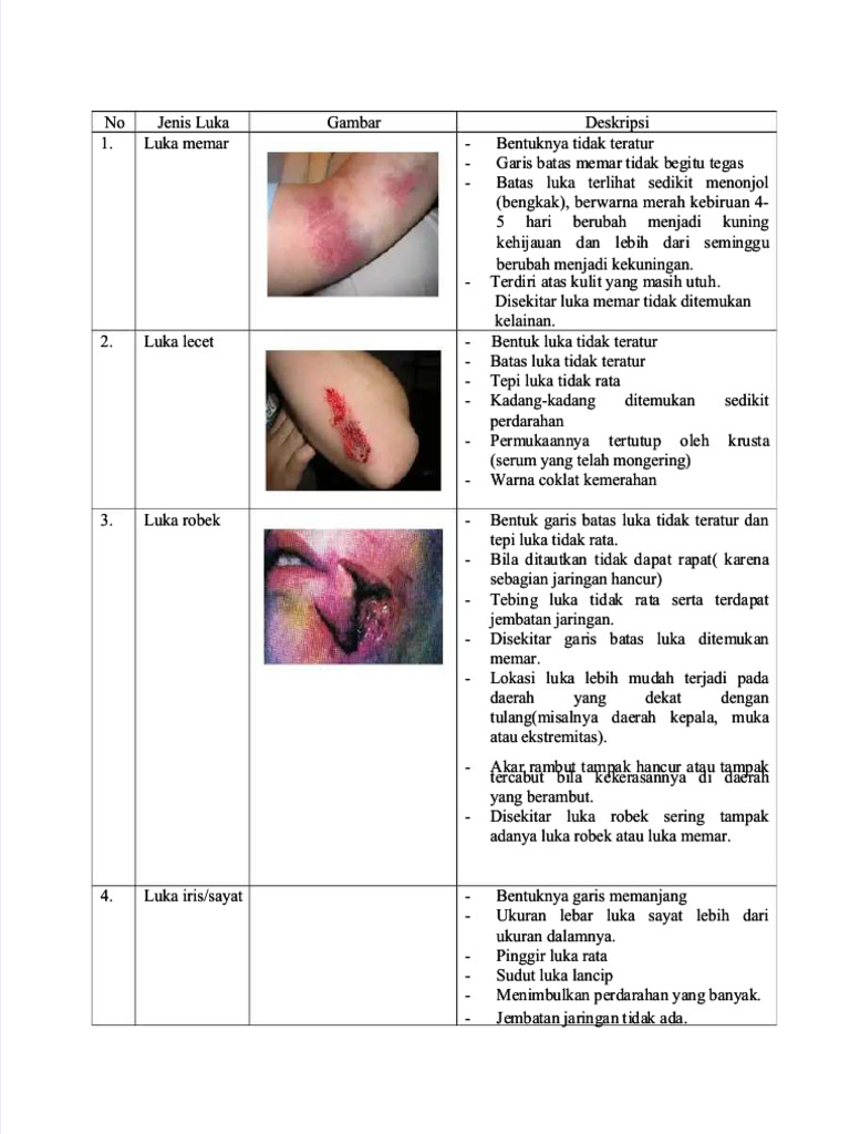 Template Luka Visum | PDF