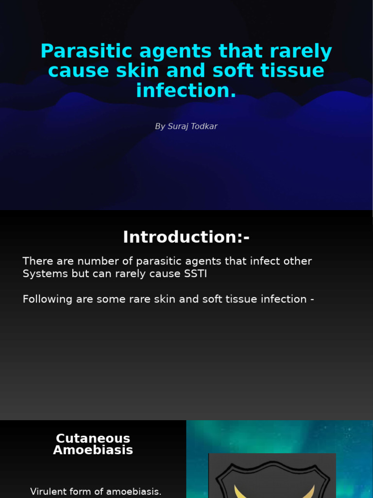 Rare Parasitic Skin Infections | PDF