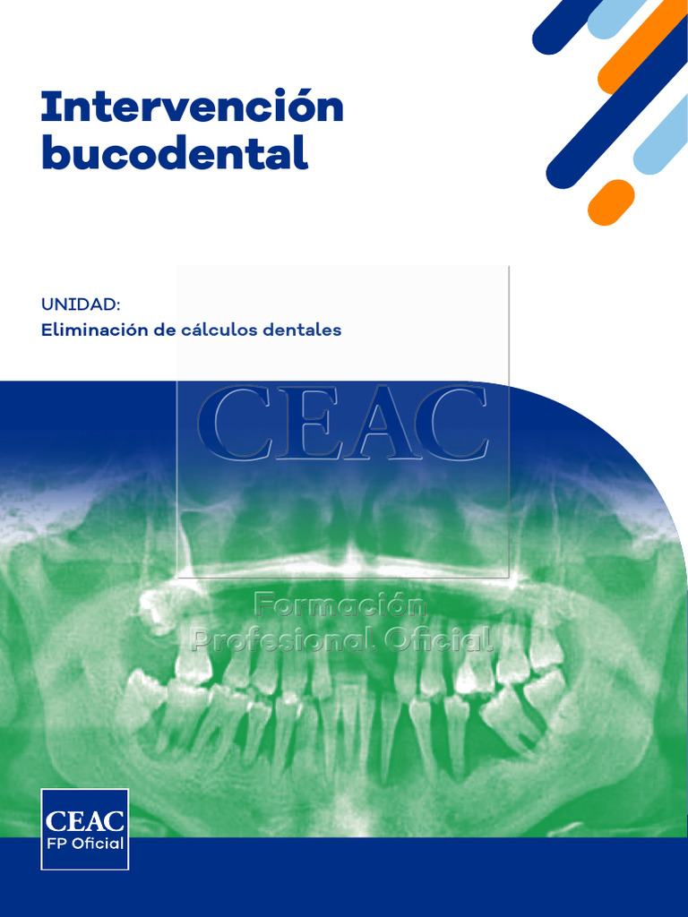 HIBU M04-UD5-Eliminacion Calculos Dentales | PDF