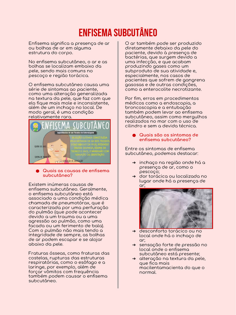 Enfisema Subcutâneo: Causas e Sintomas | PDF | Doença de obstrução ...