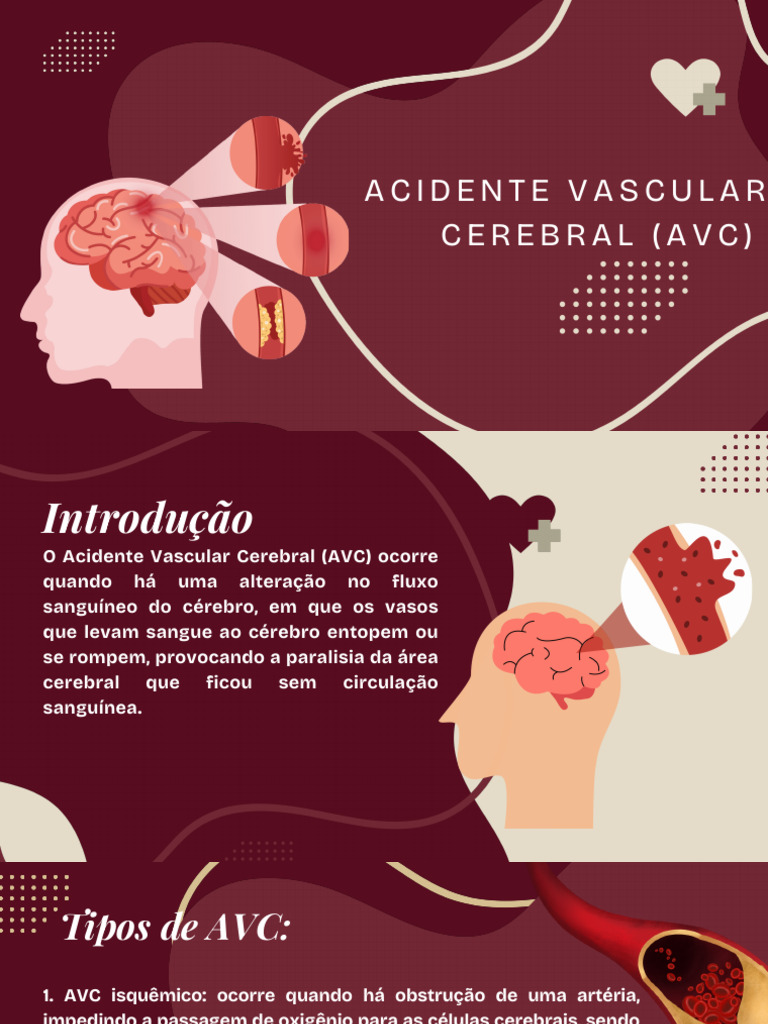 AVC Esclerose e Parkison | PDF | AVC | Mal de Parkinson