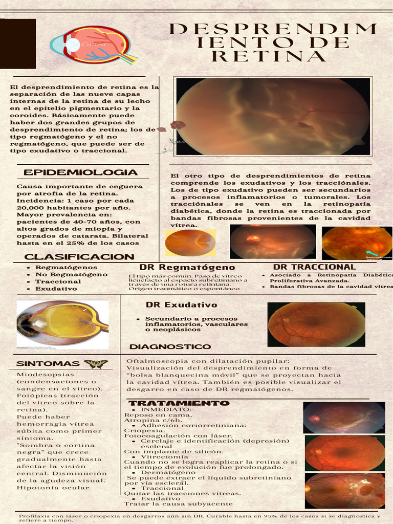 Infografía Importancia de La Lectura Collage Café y Beige | PDF ...