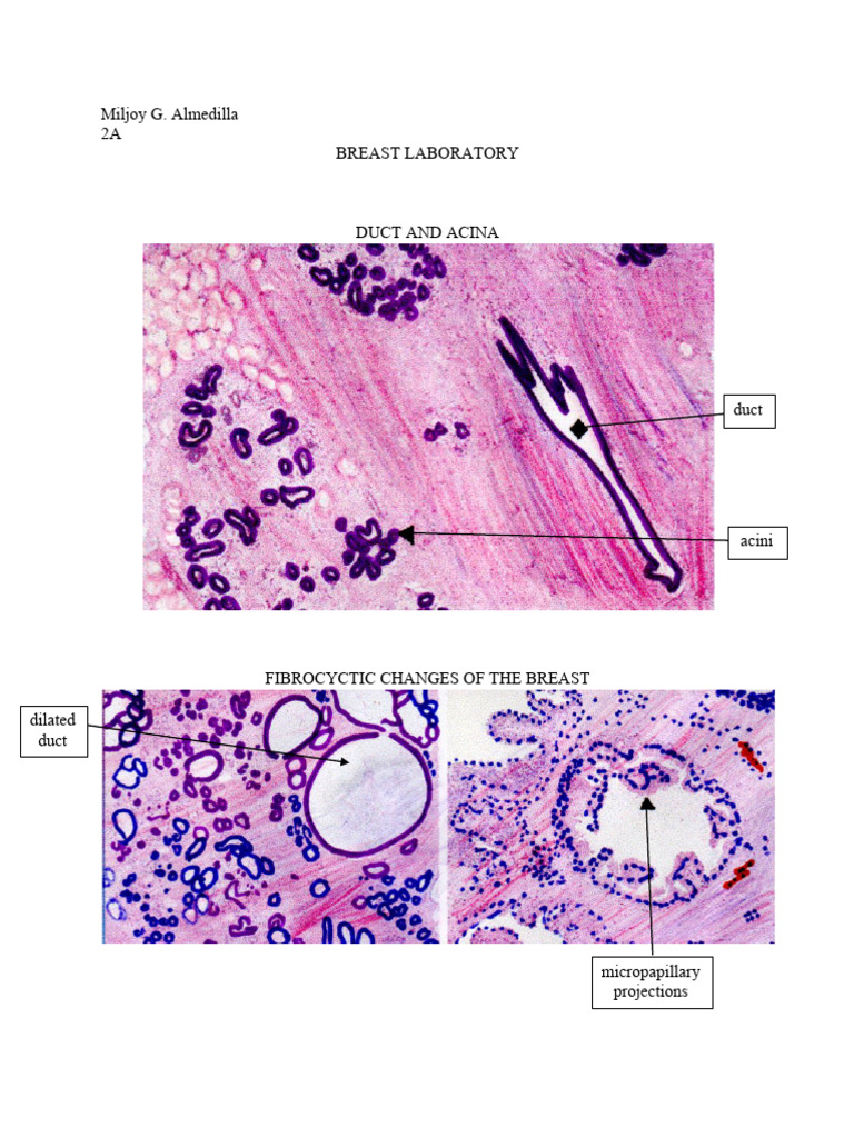 Breast Lab | PDF