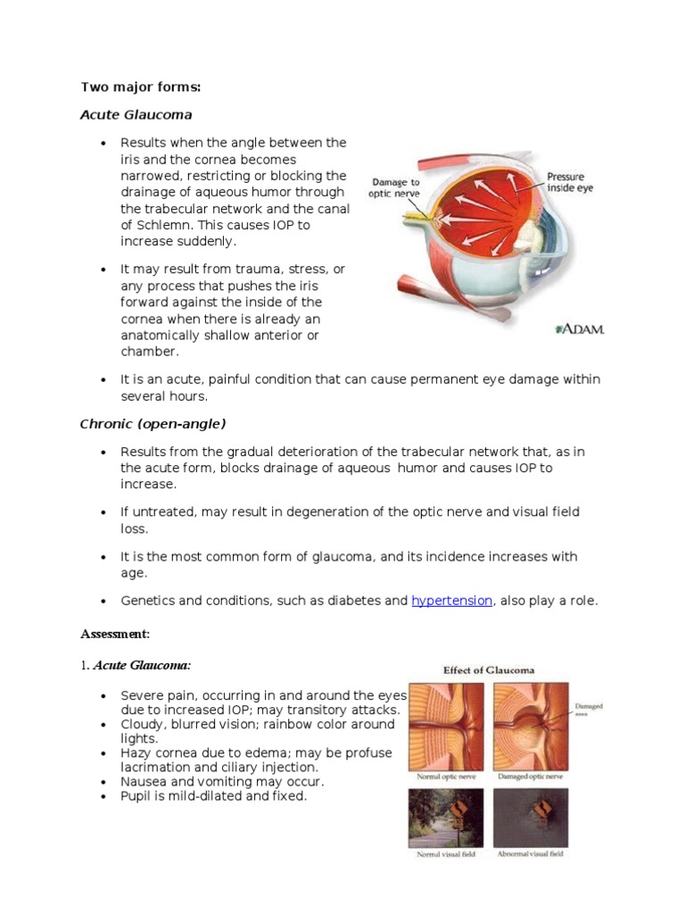 Two Major Forms of Glaucoma: Acute and Chronic | PDF | Glaucoma | Visual System