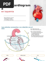 Isquemia y Necrosis en ECG | PDF | Electrocardiografia | Infarto de ...