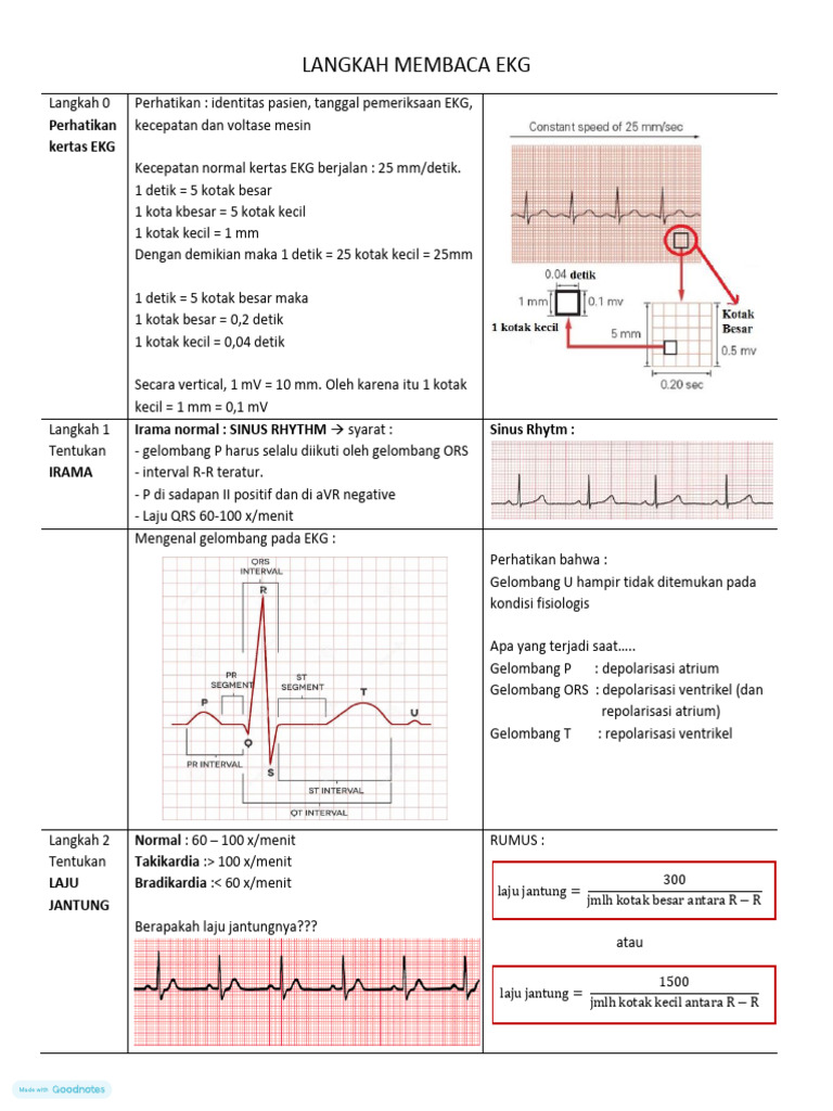 LANGKAH MEMBACA EKG (1) | PDF