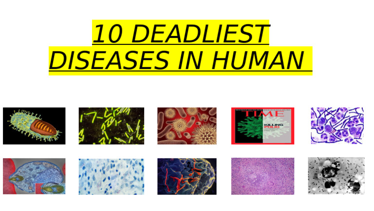 Top 10 Deadliest Human Diseases | PDF