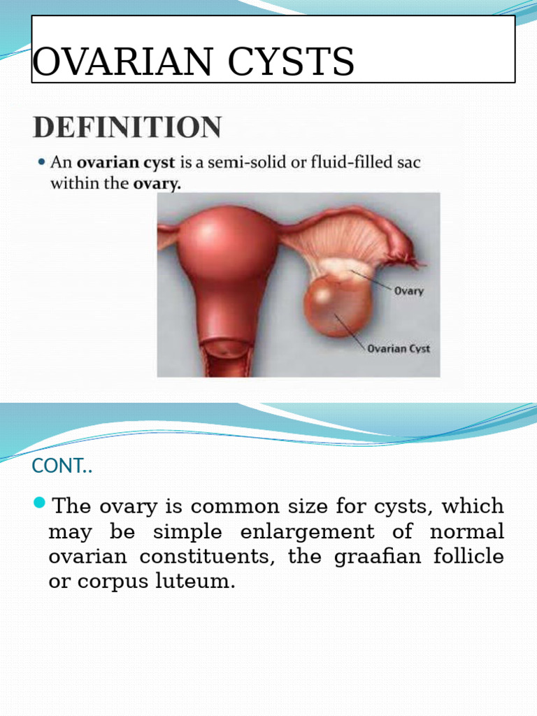 Ovarian Cysts | PDF