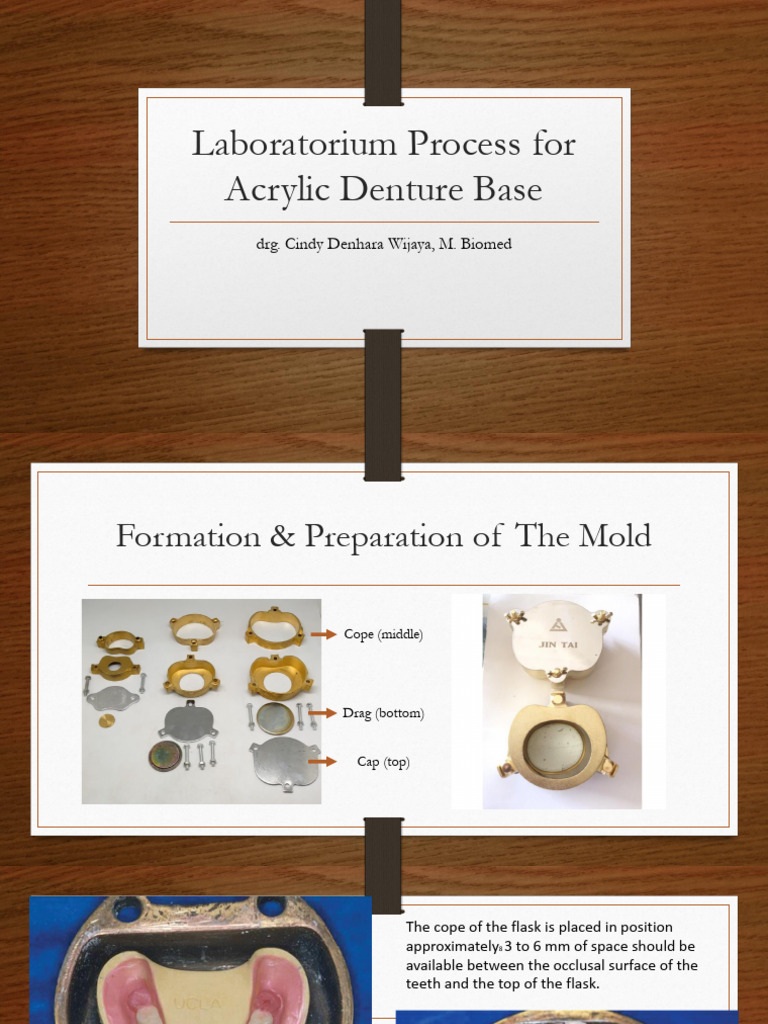 Acrylic Denture Base Lab Process Guide | PDF | Dentures | Plaster