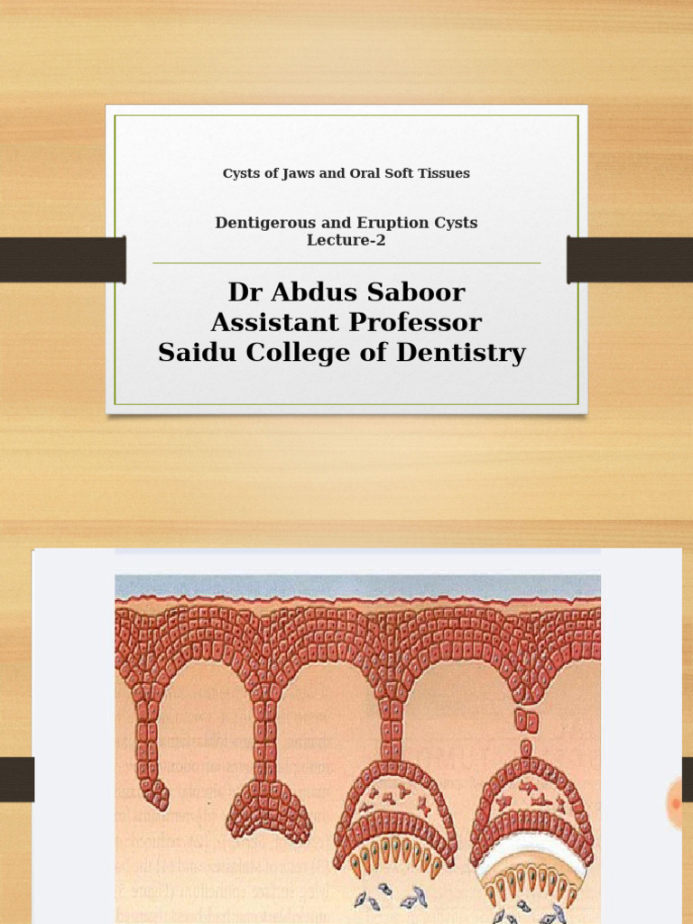 Dentigerous and Eruption Cysts Overview | PDF | Dentistry Branches ...