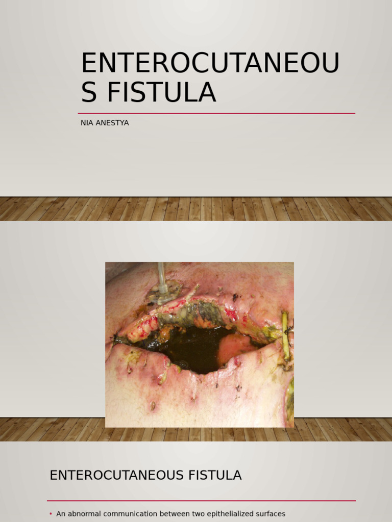 Enterocutaneous Fistula | PDF | Gastrointestinal Tract | Digestive System