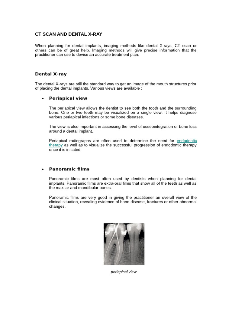 CT Scan and Dental X | PDF | Dental Implant | Ct Scan