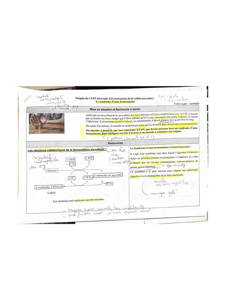 Open Exao SVT PDF | PDF