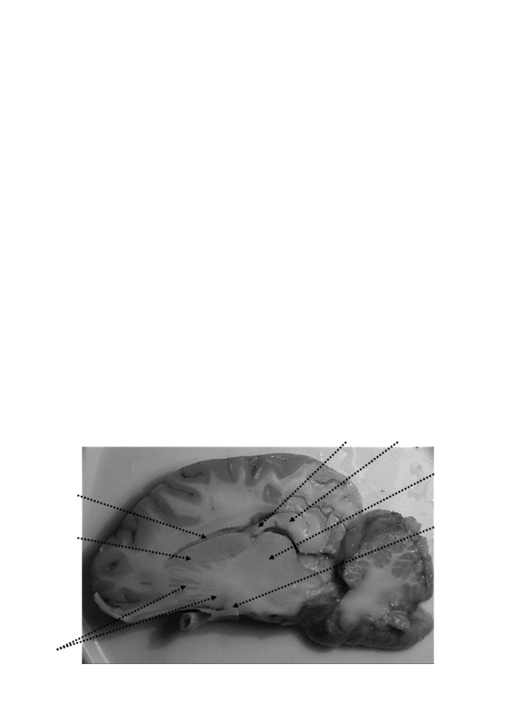 Lateral Sagittal View Sheep Brain | PDF | Cerebrum | Thalamus