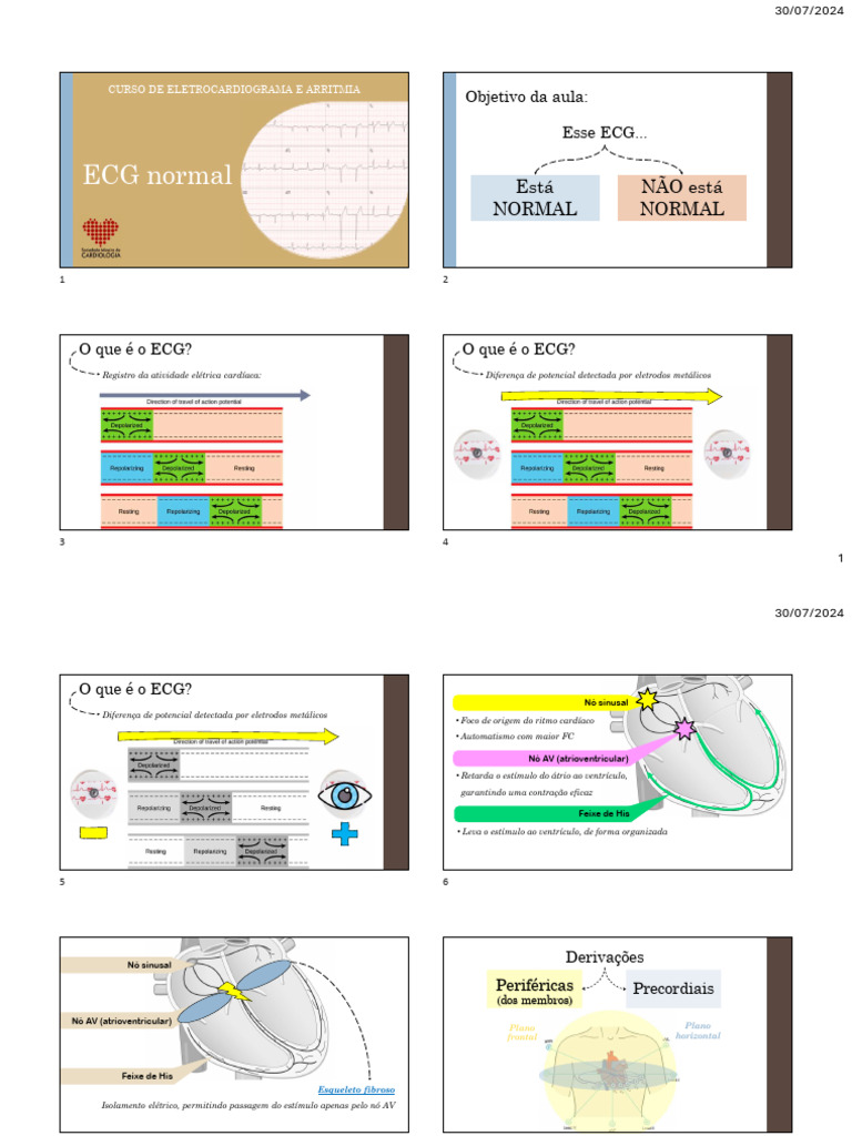ECG Normal: Análise e Interpretação | PDF | Átrio (coração) | Sistema ...