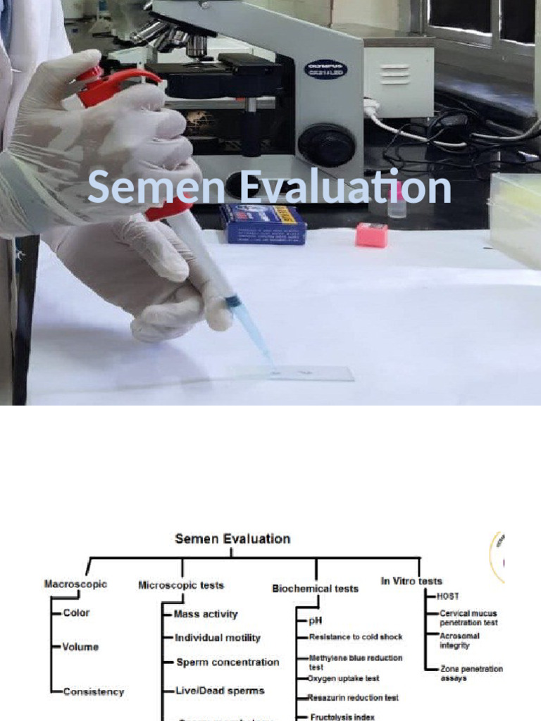 semen evaluation | PDF | Semen