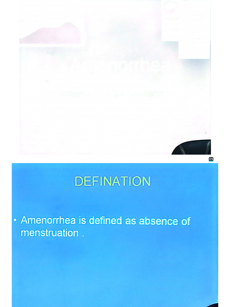 Primary Amenorrhea | PDF