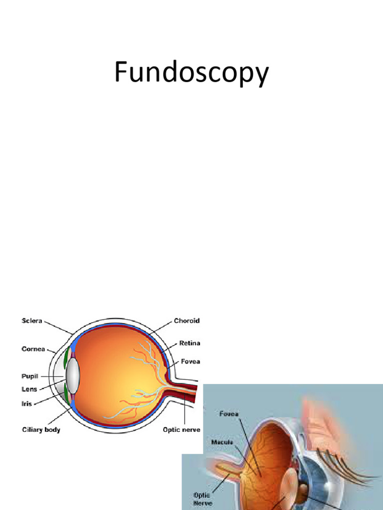 Fundoscopy 2018 Handouts Compressed | PDF | Human Diseases And ...