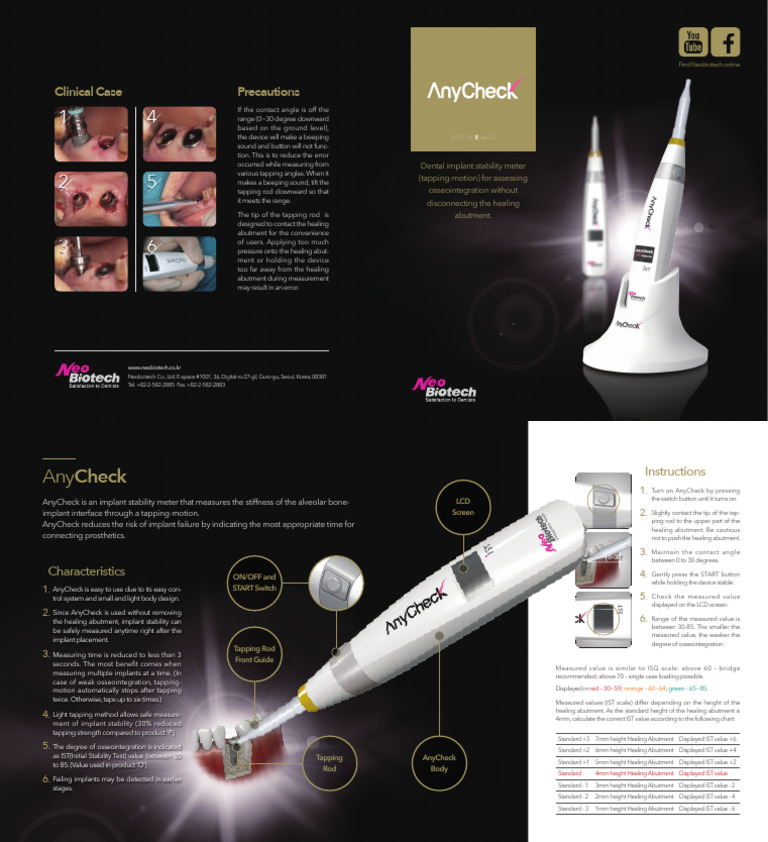 62faf8ad9cb0ad44e95aca9e AnyCheck 2017.10 Ver.2 | PDF | Dental Implant