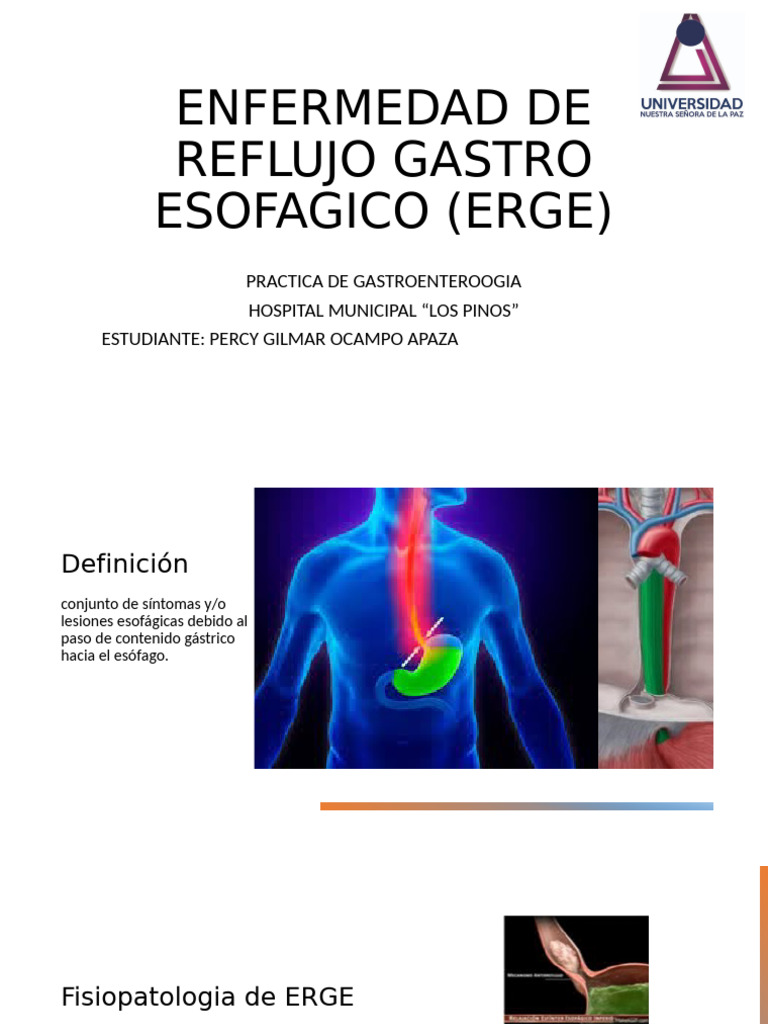 Enfermedad de Reflujo Gastro Esofagico (Erge) | PDF