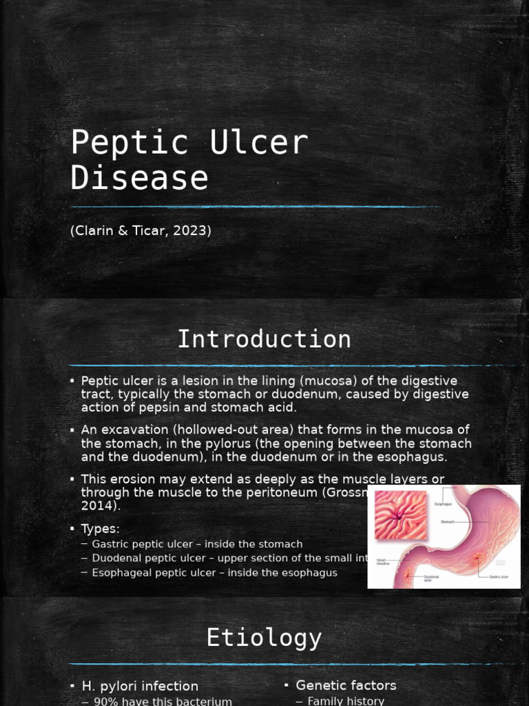 Understanding Peptic Ulcer Disease | PDF | Stomach | Gastroenterology