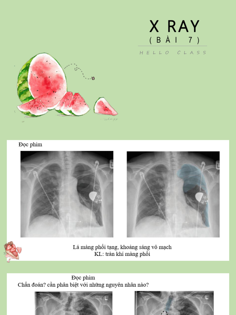 Bai7 Xray | PDF