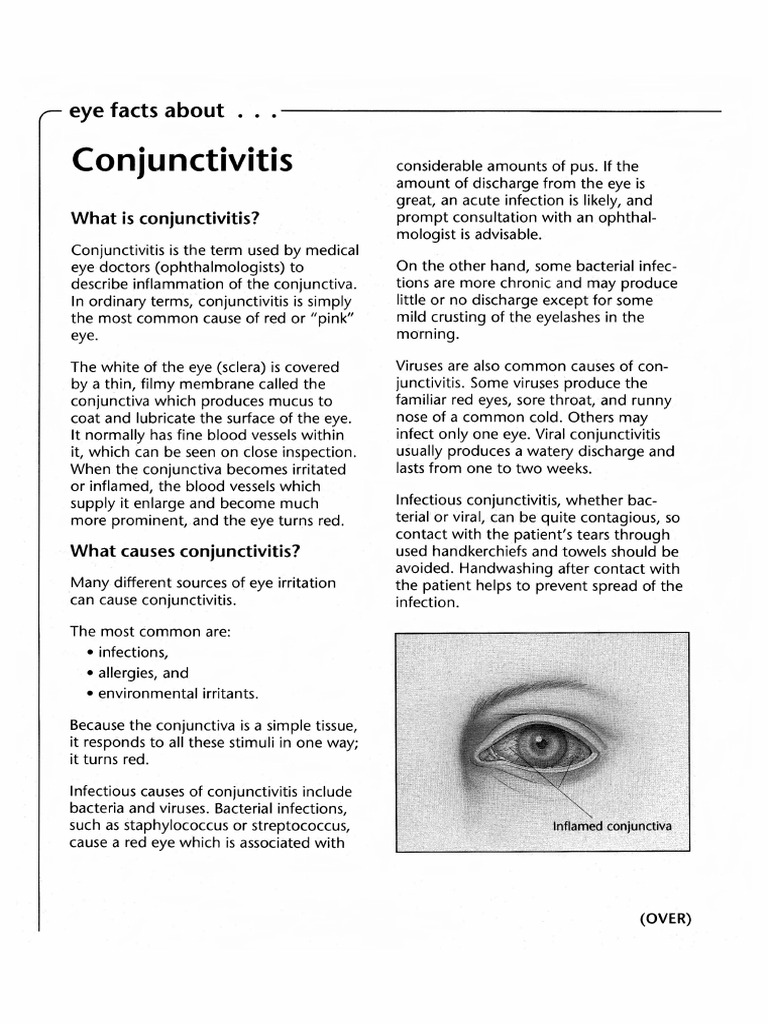 AAO - Conjunctivitis | PDF