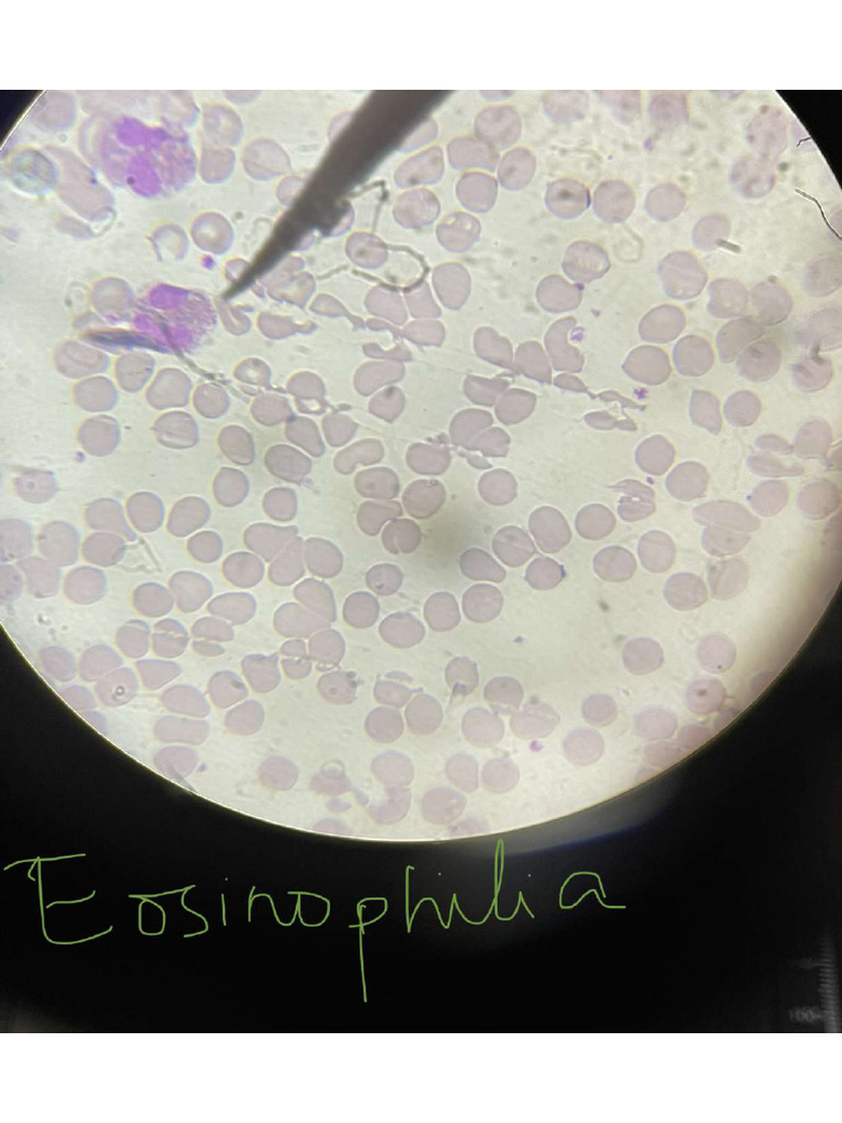 Haematology Spotter slides | PDF