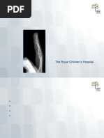 Boxer Fracture Rehabilitation Protocol | PDF | Injury | Musculoskeletal ...