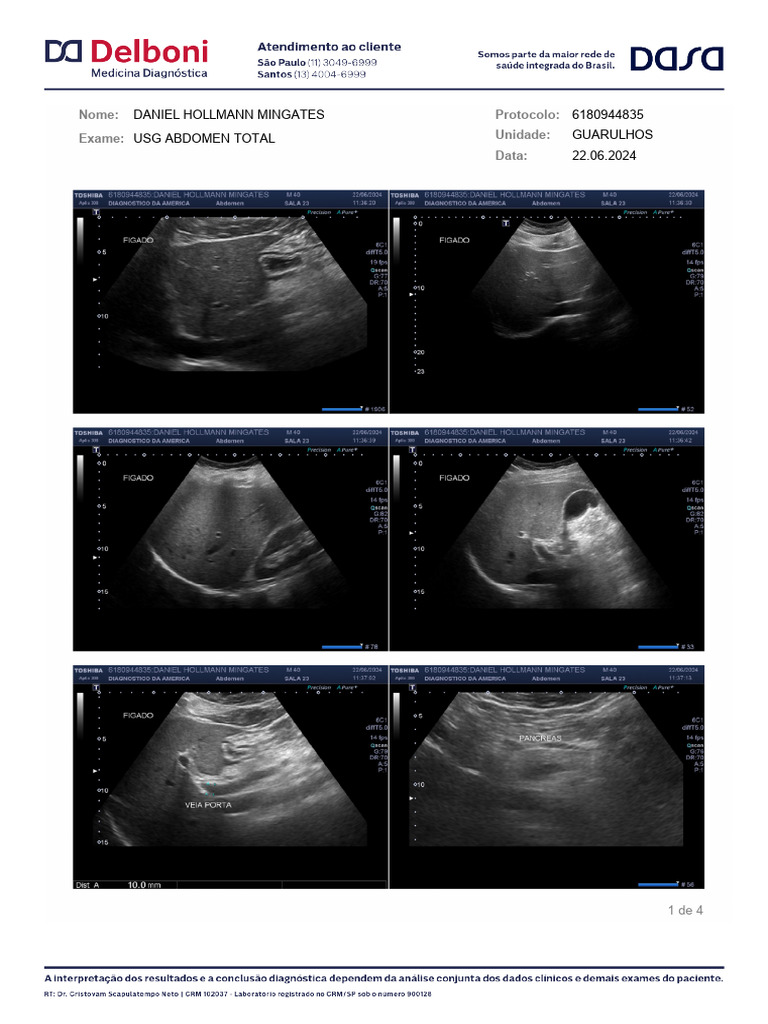 Ultrassonografia Do Abdome Total (Série de Impressão-Imagens) | PDF