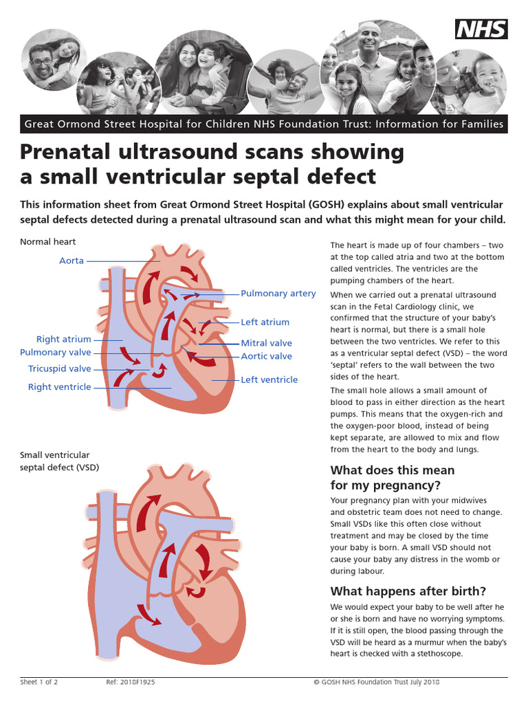 Prenatal VSD Diagnosis and Care Guide | PDF | Ventricle (Heart) | Heart ...