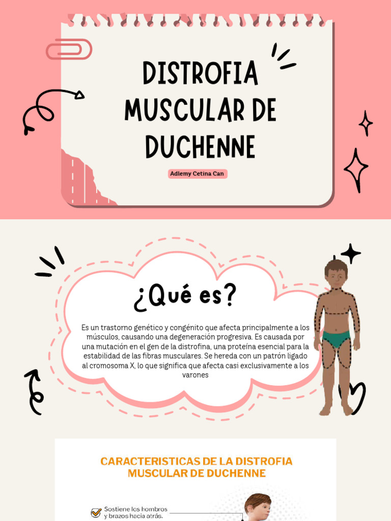 Distrofia Muscular de Duchenne: Síntomas y Tratamiento | PDF ...
