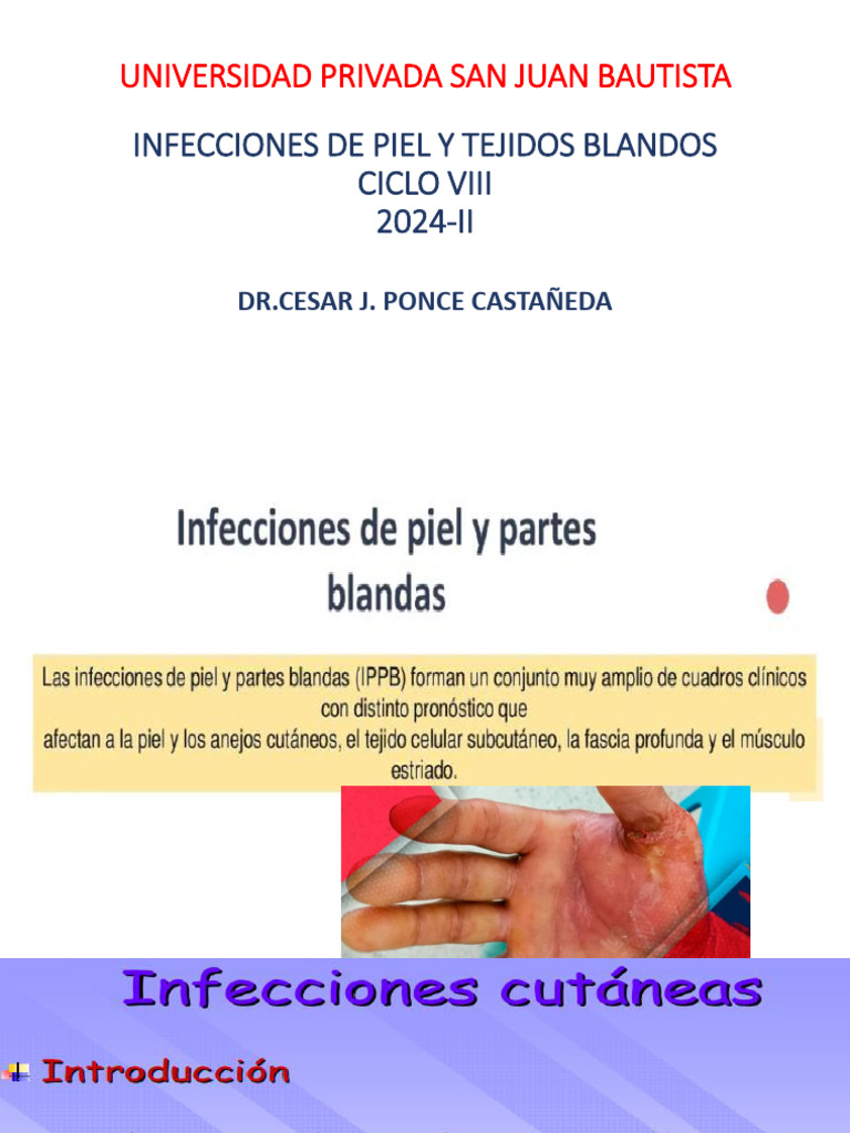 INFECCIONES PIEL Y TEJIDOS BLANDOS | PDF