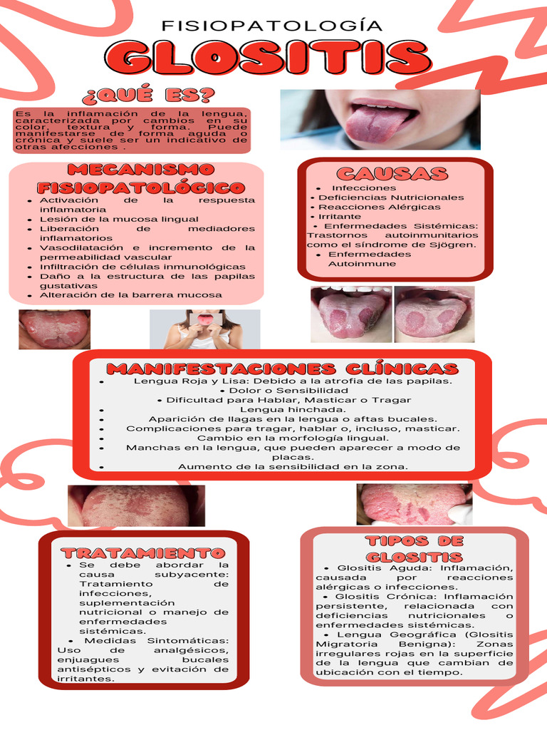 Glositis | PDF | Inflamación | Alergia